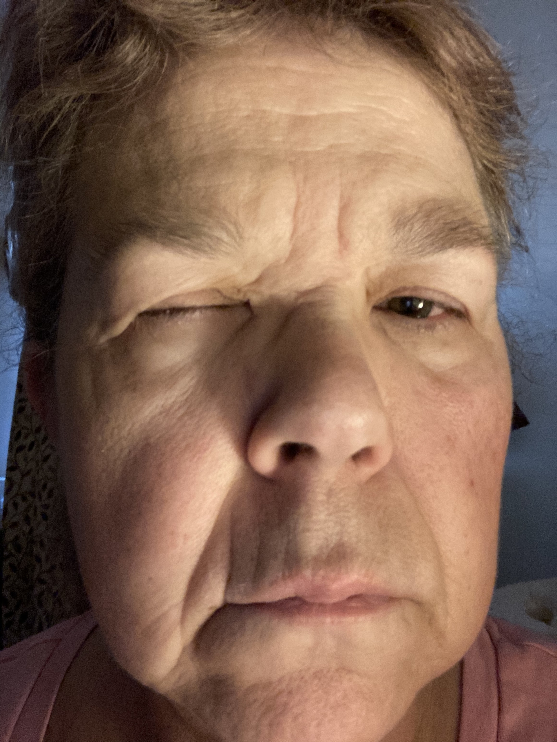 Elaine H. – Humans of Chronic Illness by Solve M.E.